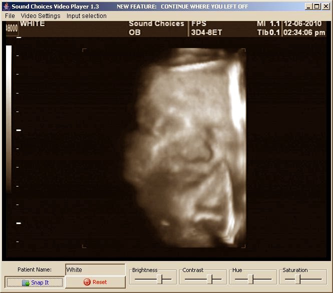 Counting Our Blessings: Jaxon's 4D Ultrasound @ 31 Weeks
