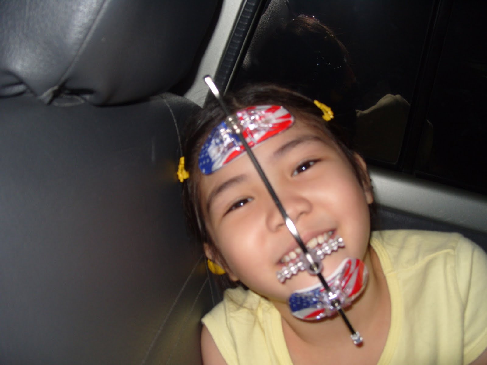 Stories From My Garden: Gina's Facemask And Palatal Expansion Therapy