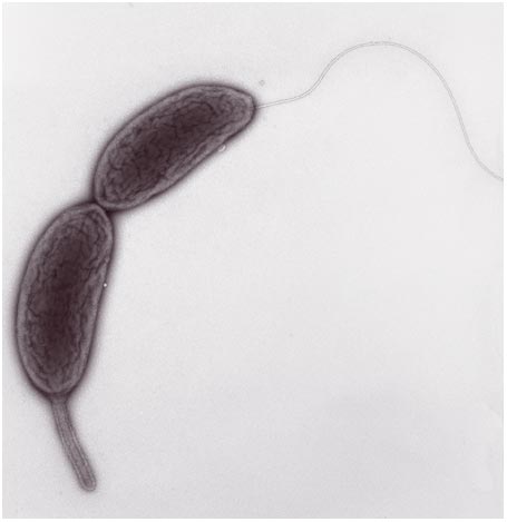 Catalogue of Organisms: Bacteria, Too, Grow Old and Die