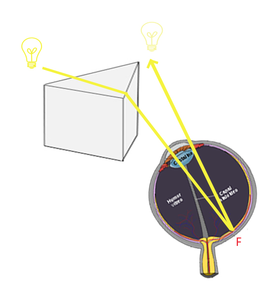 Tecnología Médica - Mención en Oftalmología: Prisma Cover Test