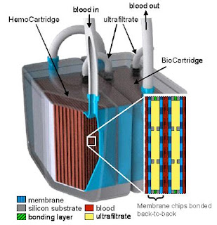 UCSF unveils model for implantable artificial kidney to replace ...
