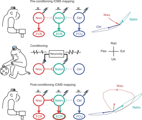 Implantable neurochips to restore brain functions have a 3 year $1 ...