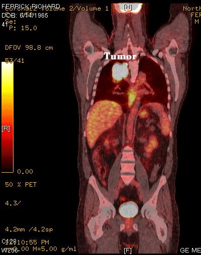 Health and Science: The wonders of PET scan