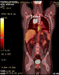 Health and Science: The wonders of PET scan