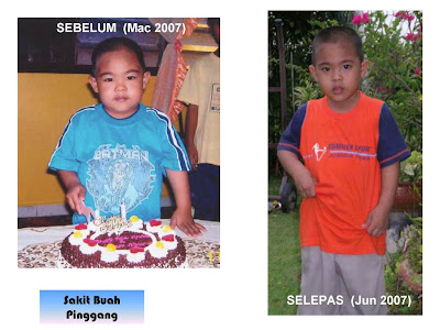 Jus Mustajab ramuan daripada 23 jenis Herba: Testimoni pengguna INTRA