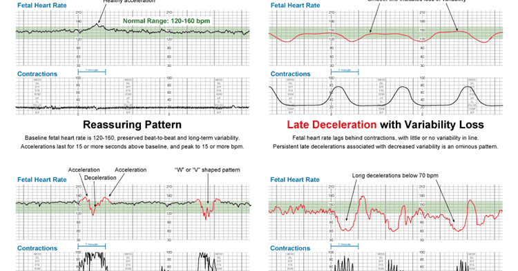 Saúde da Mulher: CTG