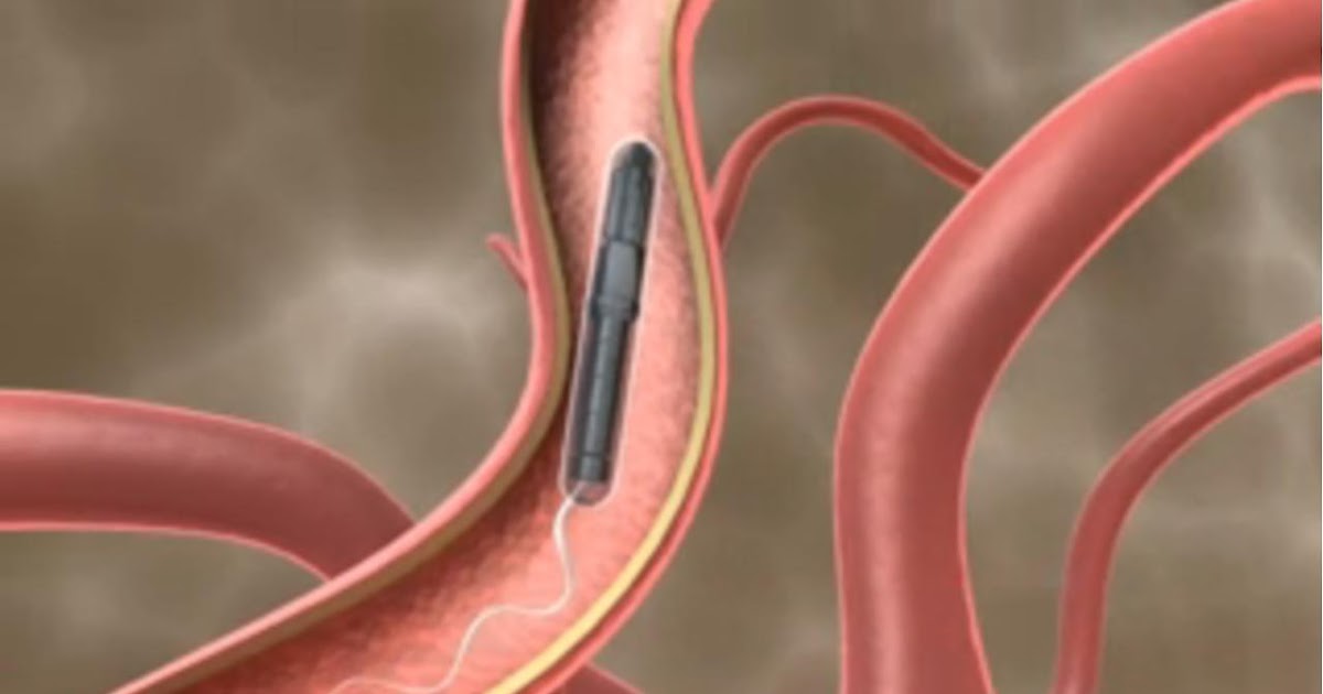 REHABILITACIÓN Y MEDICINA FÍSICA. Mirando al futuro.: El viaje ...