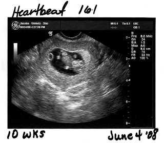 The Adams Family: Sonogram pictures...10 weeks...Baby Monkey