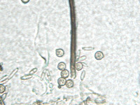 MICOLOGIA PANAMENSIS: NOTAS MICOLOGICAS(95).OBSERVACIONES SOBRE EL ...