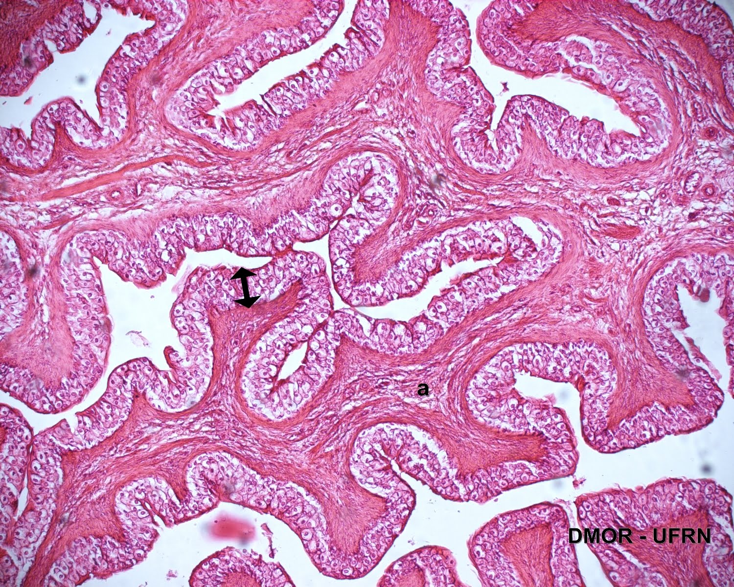 Ciências Morfológicas - UFRN: Bexiga