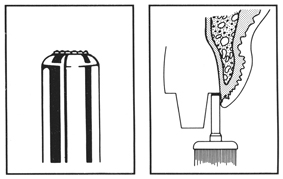 Premiere Dental: Shofu: Diamond Points