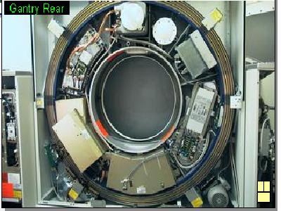 CT Scan Part Two | Biomedical Engineering Elektromedik