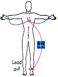 Basic ECG - BangBel
