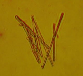 PRO VETS CLINICA VETERINARIA: UROLITIAISIS EN PERROS