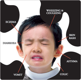 THE DOCTOR: Symptoms of cow’s milk allergy