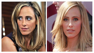 Plastic Surgery Before And After: Kim Raver Nose Job