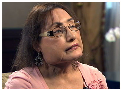 Plastic Surgery Before And After: Connie Culp Before And After