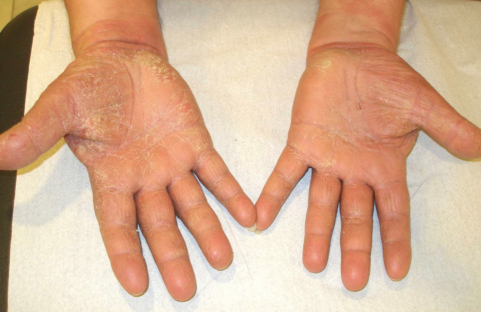 Noticias de Salud: Investigadores demuestran que hasta para los peores ...