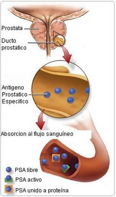 PSA:El antígeno prostático específico