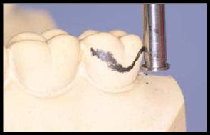 Laboratorio Dental II - UNEFA: Guía de Estudio Nº1. El Paralelígrafo ...