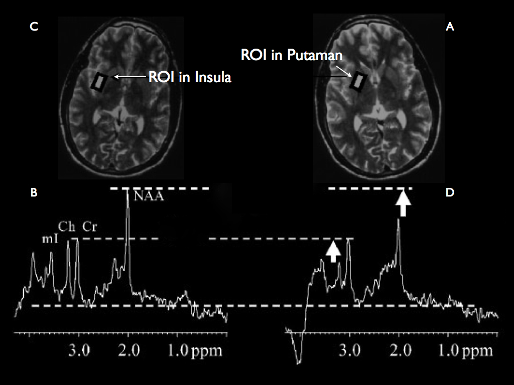 MRI BLOG: Spectral Quality & Artefacts