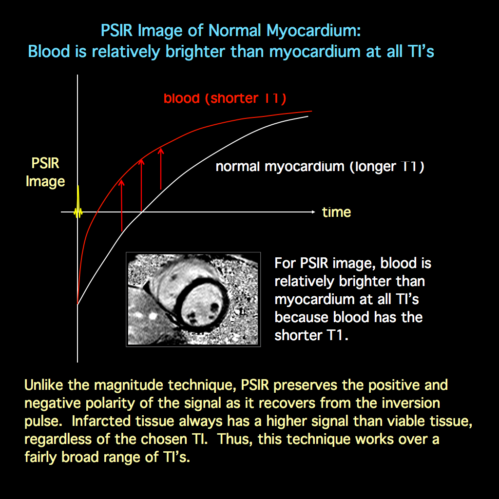 MRI BLOG: Pulse Sequences for Cardiac MRI