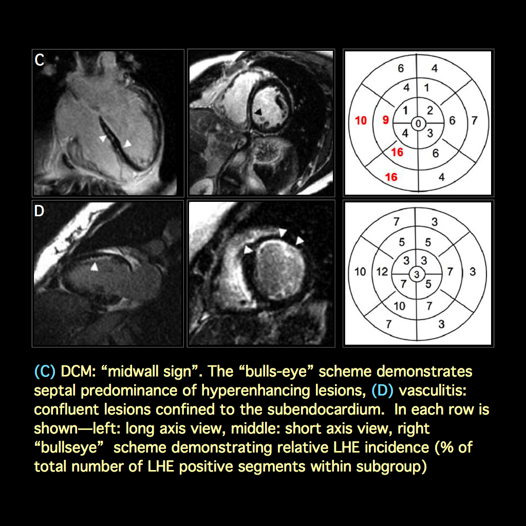 MRI BLOG: Imagery of Cardiac Pathology