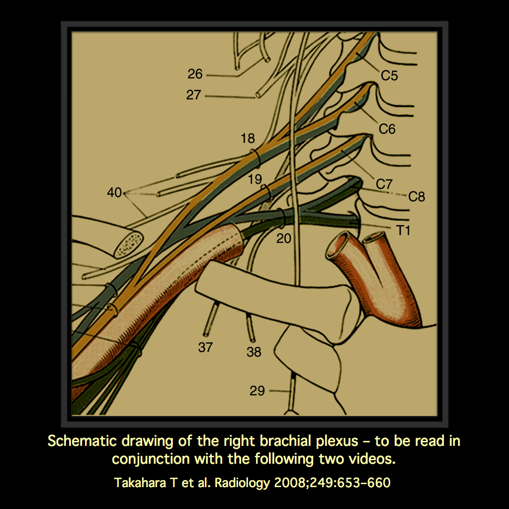 Brachial Plexus Anatomy