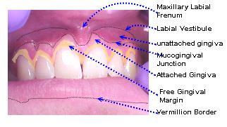 Doctors Gates: Anatomical parts of Gingiva