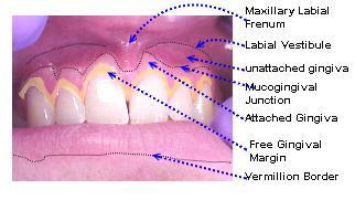 Doctors Gates: Anatomical parts of Gingiva