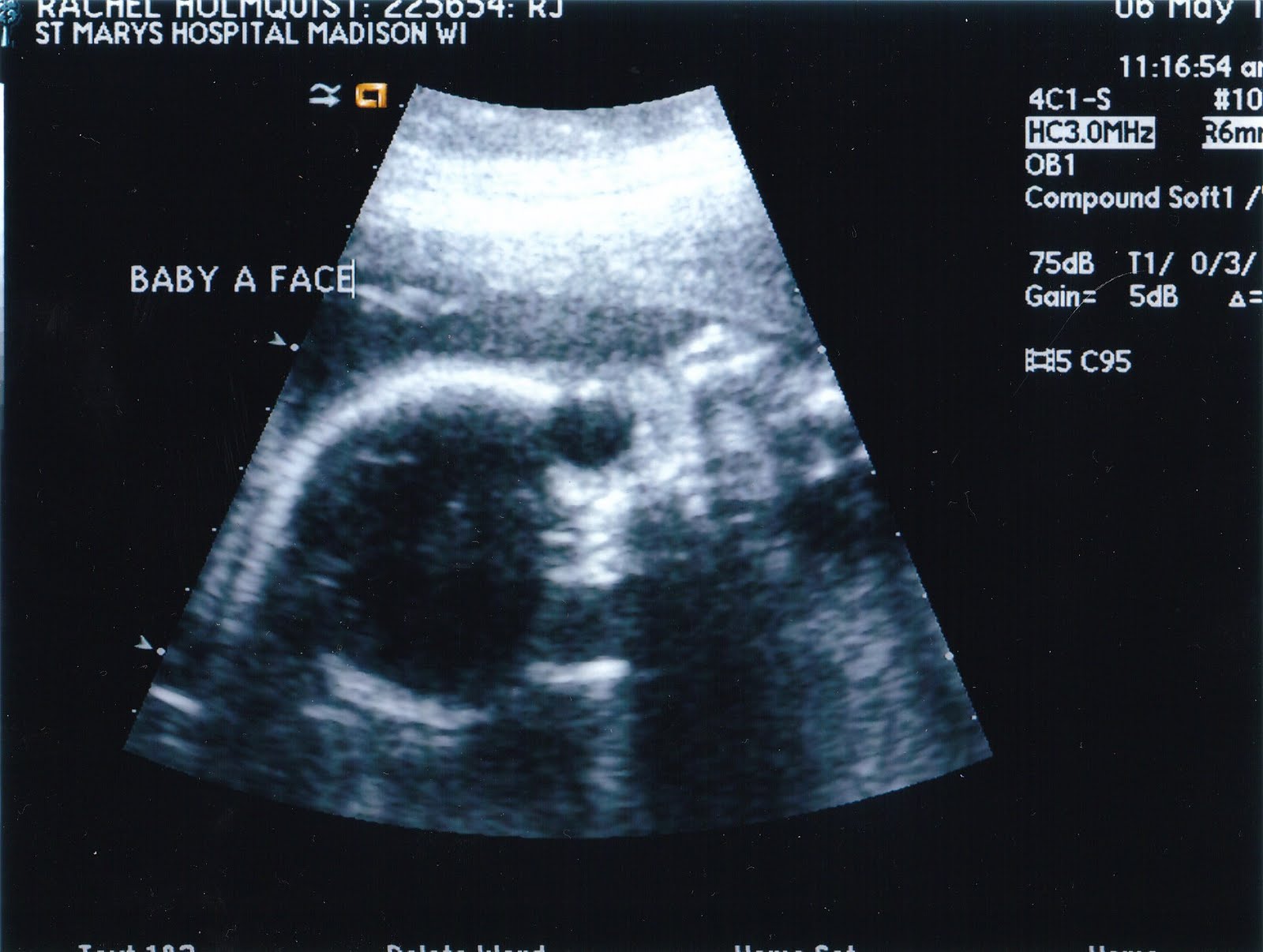 Gilberquist Family: 26 week ultrasound pictures