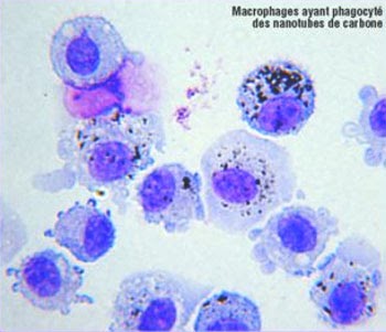 Desvendando a patologia: Macrofagos