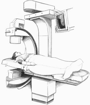 fluoroscopy