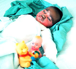 Jeannette Hernández: fotografias de incendios y niños quemados.