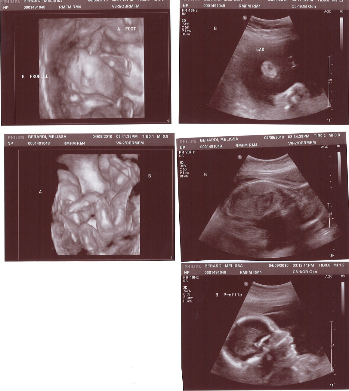 810 House and Garden: 24 Week Ultrasounds