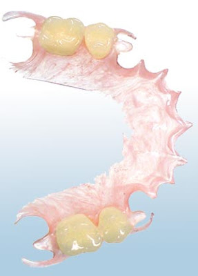 DRA. TALITHA MELLO - DENTISTA: Próteses deflex - Uma nova alternativa ...