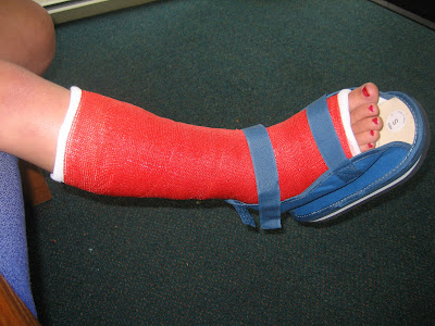 My Dog Ate It...: First Broken Bone!