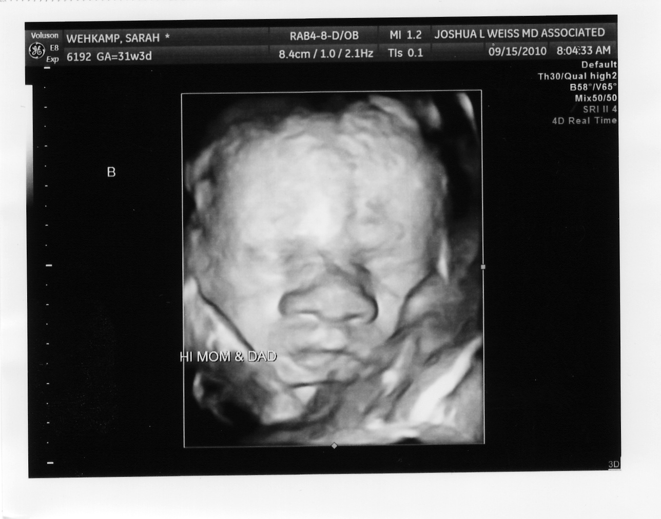 The Wehkamps: 31 Weeks