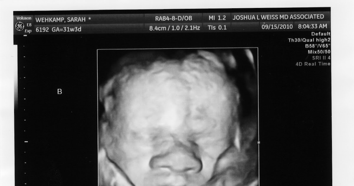 The Wehkamps: 31 Weeks