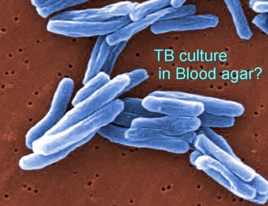 TB culture in Blood agar | iNVISIBLE YET iNVINCIBLE