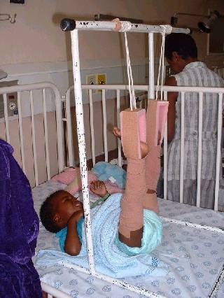 MEDICAL IMAGES: Gallows traction