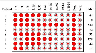 Immuno: 1.Direct agglutination