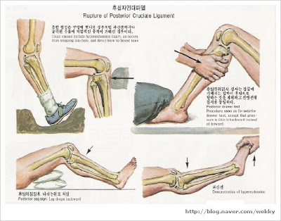 X. Wheel of Fortune: Injury of the knee