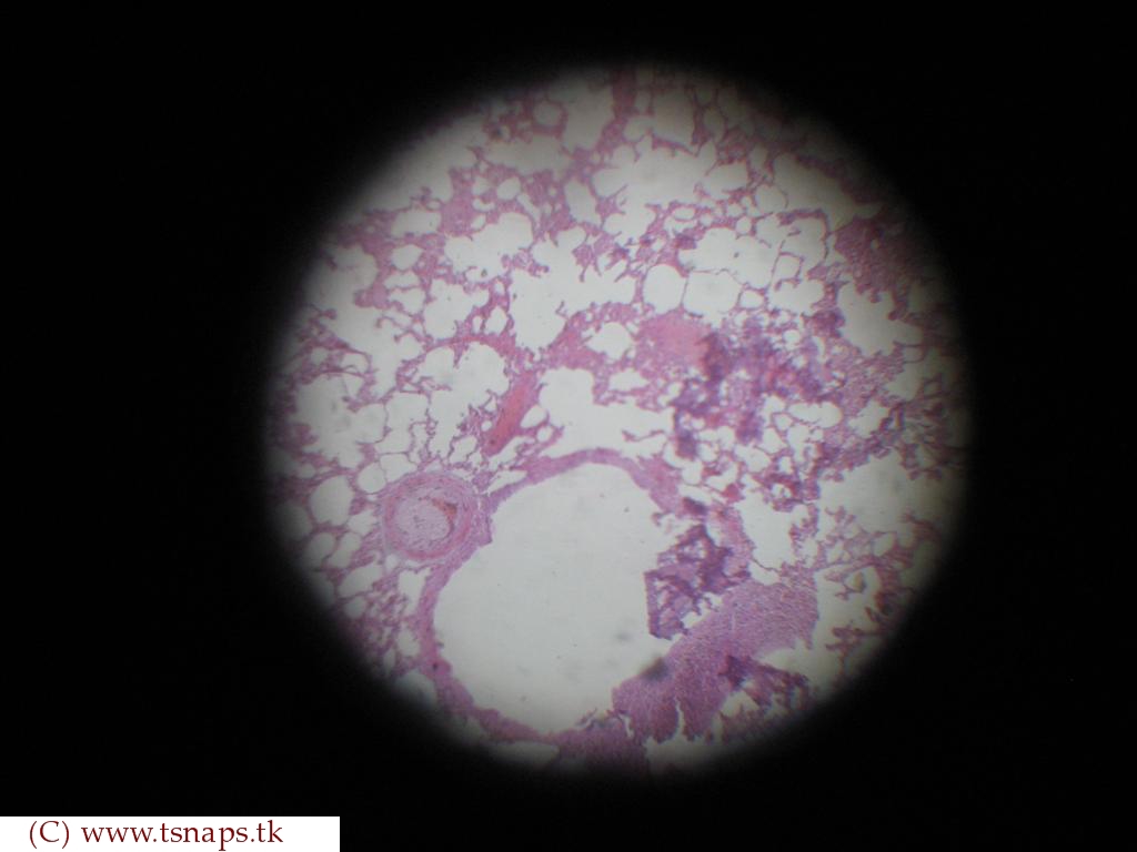 Histology Slides Database Simple Squamous Epithelium Lung Histology Slide histology-slides-database-simple-squamous-epithelium-lung-histology-slide