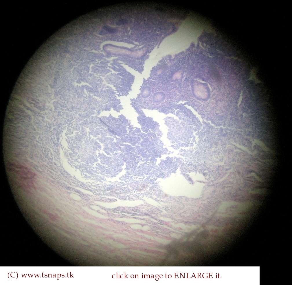 Histology Slides Database: Appendix histology slide (vermiform appendix ...