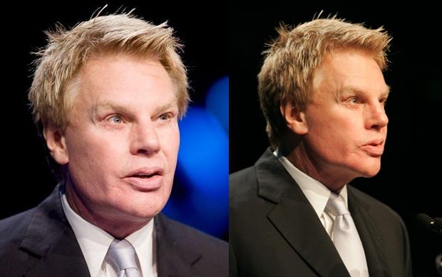 Mike Jeffries CEO Plastic Surgery