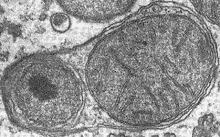 El mundo de la Biologìa: Los lisosomas, su estructura, funciones y ...