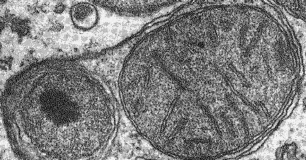 El mundo de la Biologìa: Los lisosomas, su estructura, funciones y ...