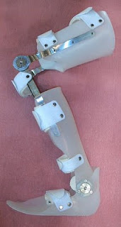 Spina Bifida Kids: Brace options