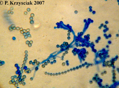 Mykologia medyczna: Scopulariopsis brevicaulis